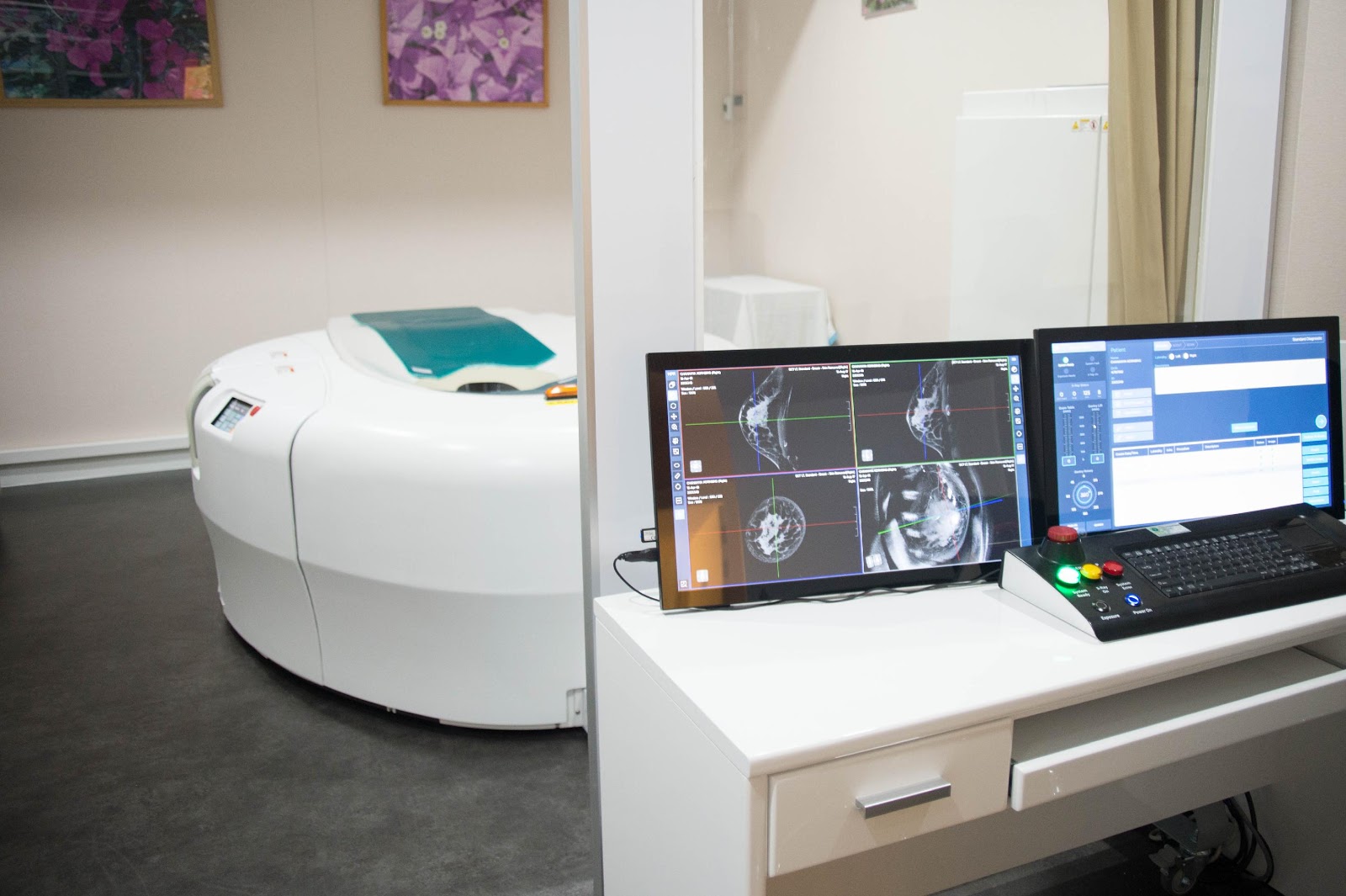 Breast Radiology Unit – Queen Sirikit Centre for Breast Cancer (QSCBC)